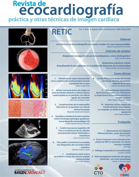 Los Técnicos En Ecocardiografía En Nuestro Medio Un Reto