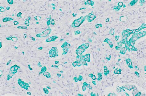 Delaunay Cluster Features In Qupath Quantification Image Analysis Image Sc Forum