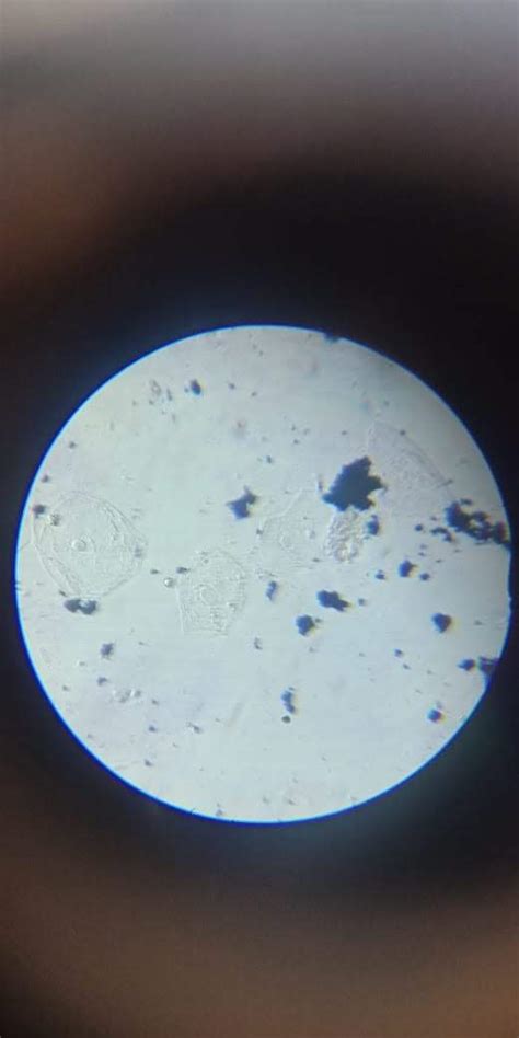 Dr Ranjana Mitochondria In Cheek Cell Stained By Janus Green B In Laboratory