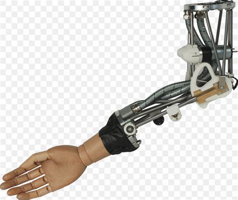 Robotic Arm Prosthesis Bionics Png 1420x1197px Robotic Arm Arm