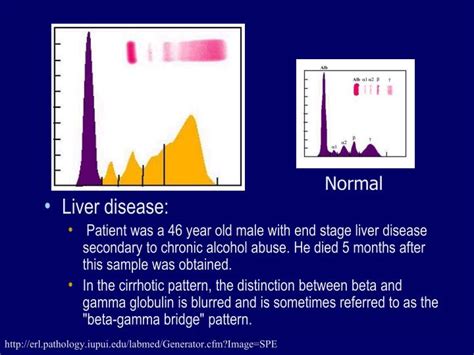 Ppt Electrophoresis And Its Application For Diagnosis Powerpoint