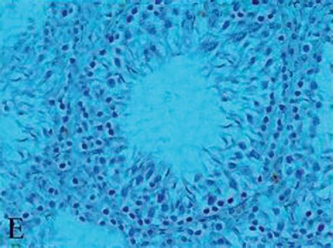 Photomicrograph Of The Testis Section Of Rat Stained With P53