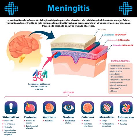 Infografías de Salud Noticias en Salud