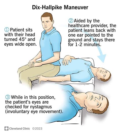 Epley Procedure At Home