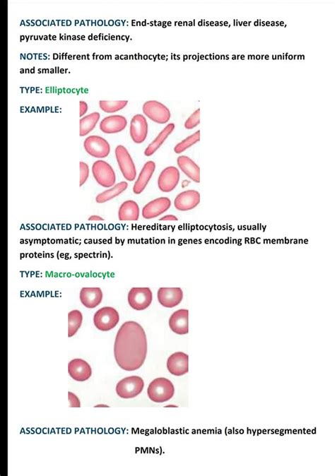Hematology And Oncologies NEET PG MedicalTalk Net The Best
