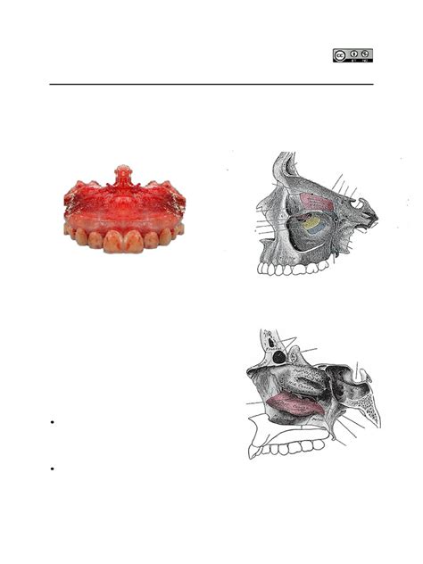 Inferior Maxillectomy Pdf Human Nose Otorhinolaryngology
