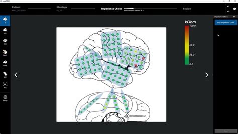 Cortiq Rapid Cortical Mapping Gtec Medical Engineering