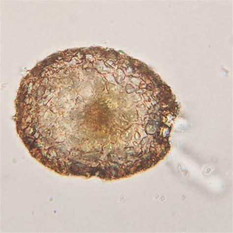 Test Pic R Microscopy