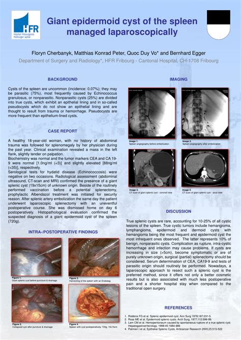 Pdf Giant Epidermoid Cyst Of The Spleen Managed Laparoscopically