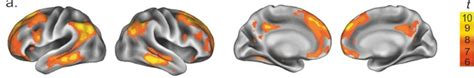 Así Cambia El Cerebro De Las Mujeres Embarazadas