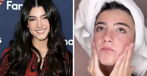 Charli D Amelio Opened Up About Her Acne Struggles And Why She Doesn T Edit Photos Of Her Face