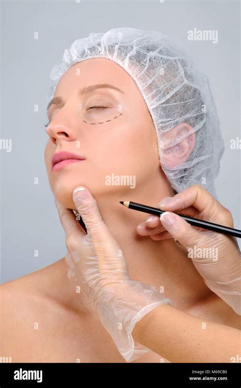 Plastic Surgery Woman With Dotted Lines On The Face Anti Aging
