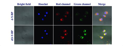 Fluorescent Microscope Imaging Of Treated Hela Cells With D Do Y Bp For