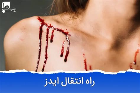 احتمال انتقال ایدز در اولین رابطه؛ واقعیت یا بزرگنمایی؟