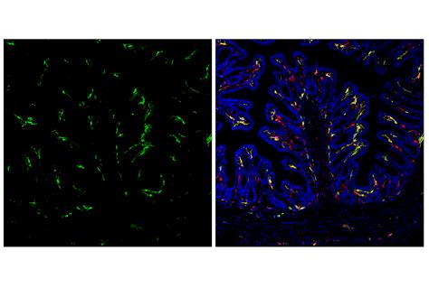 Cst Mhc Class Ii I A I E M5 114 15 2 Rat Mab Fitc Conjugate 优宁维