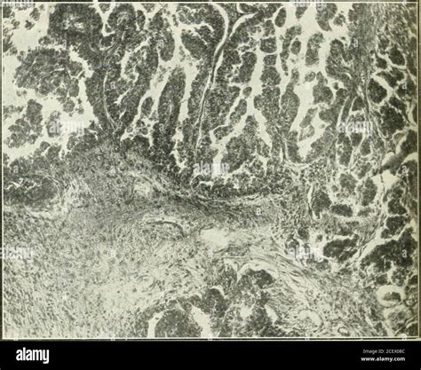 A manual of gynæcology and pelvic surgery for babes and practitioners ing into their