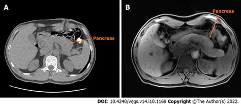 Computed Tomography And Magnetic Resonance Imaging Scan Of The Download Scientific Diagram