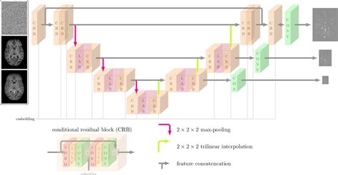 Figure 1 From Faithful Synthesis Of Low Dose Contrast Enhanced Brain Mri Scans Using Noise