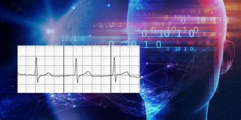 Con lintelligenza artificiale si può far diagnosi allECG di