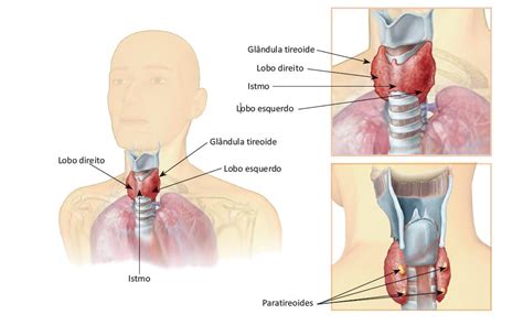 Cirurgia Da Tireoide Como é E Indicações Nicap