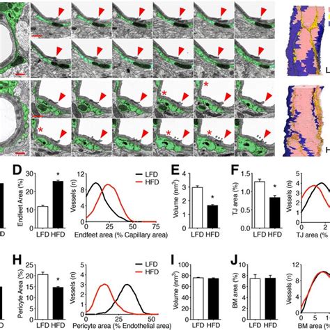 Three Dimensional Ultrastructure Of Bbb Breakdown In Mice With