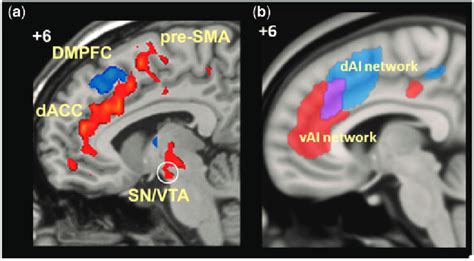 A Salience Network Red As Originally Defined In Seeley Et Al