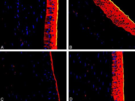 Transferase Mediated DUTP Digoxigenin Nick End Labelling TUNEL Assay