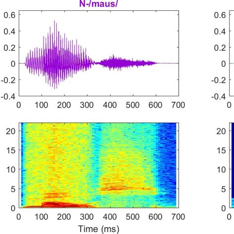 Collapsed Localizer Grand Average Erp Waveforms At Electrode Position
