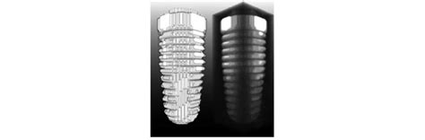 Example Of Voxelized Implant Volume At Left And Simulated Implant