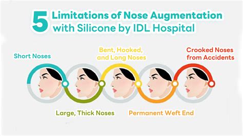 5 Limitations Of Nose Augmentation With Silicone By IDL Hospital