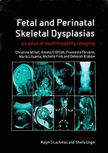 Fetal And Perinatal Skeletal Dysplasias An Atlas Of Multimodality