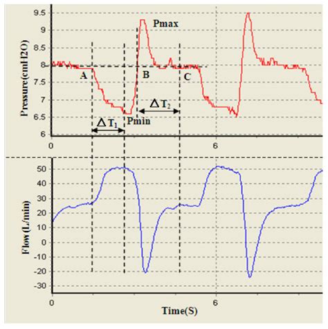Graphic Measurement Of Minimum Inspiratory Pressure Pmin Maximum Download Scientific Diagram