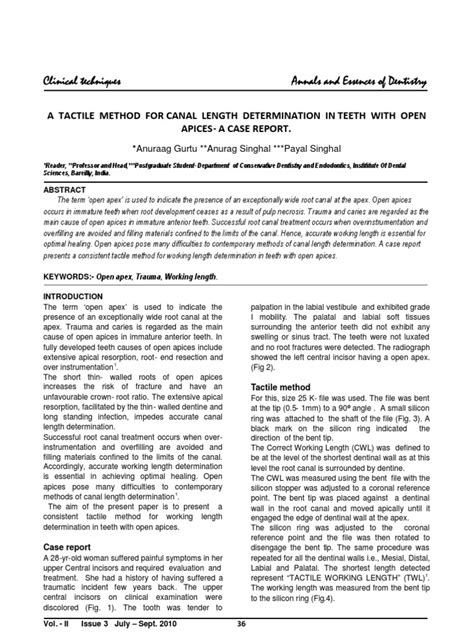 A Tactile Method For Canal Length Determination In Endodontics Pdf