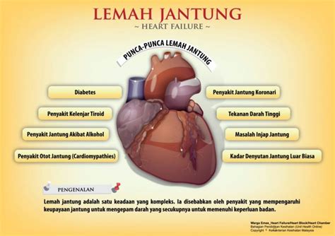 Ciri Ciri Penyakit Jantung Lemah Dan Cara Mencegahnya SayangHidup