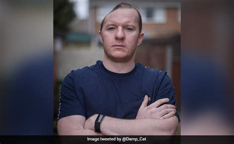 Uk Man Missing Half His Skull After One Punch Assault Wears Helmet To