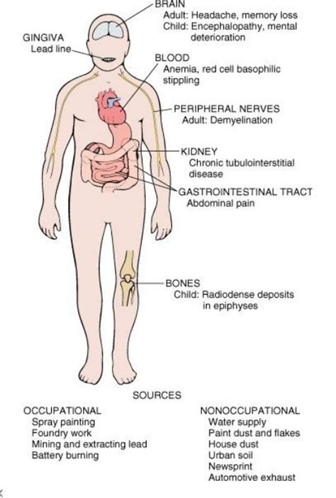 40 Best Lead Poisoning Images On Pinterest Lead Poisoning Lead Free