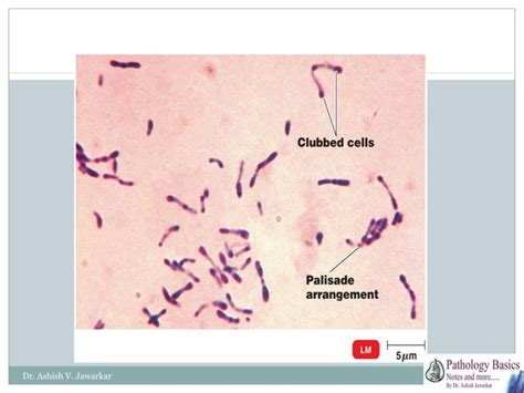 Respiratory Infections Microbiology