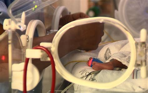 Entenda Import Ncia E O Que Fazer Para Manter Taxa De Mortalidade Infantil Em Queda Em Campinas