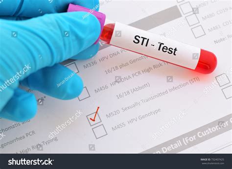 Sti Test Images Stock Photos Vectors Shutterstock