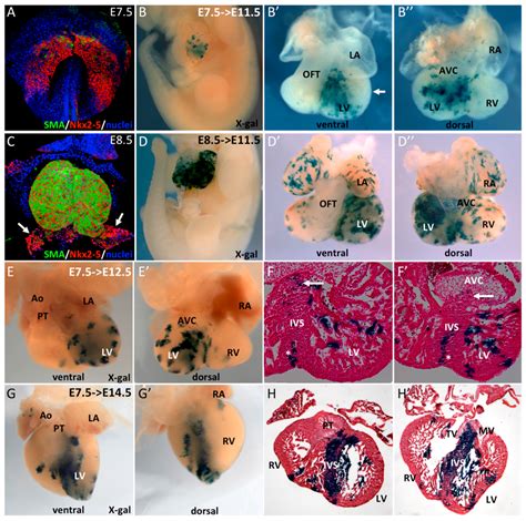 JCDD Free Full Text Segregation Of Central Ventricular Conduction