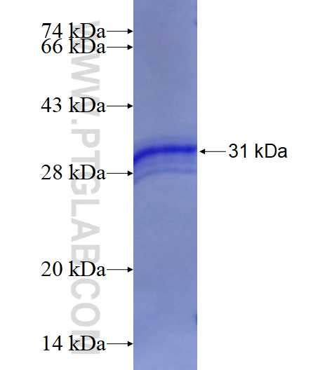 Cd4 Fusion Protein United Bio Research