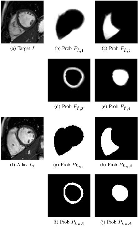 Intensity Images And The Probabilistic Label Maps For Target And Atlas