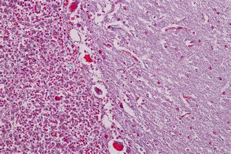 Cerebral Cortex Human Spinal Nerve Motor Neuron Under Microscope Stock
