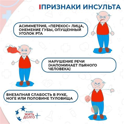 Первые признаки инсульта В предыдущем посте мы рассказывали историю пациента Сергея у которого