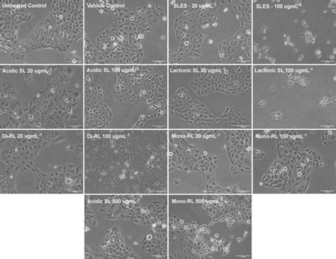 The Effects Of Glycolipids And SLES On HaCaT Cellular Morphology And