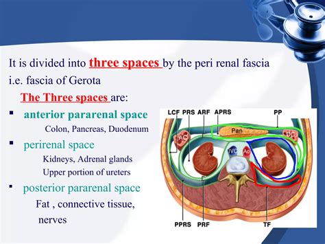 Retroperitoneal Mass Ppt