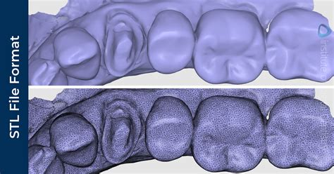 Understanding Stl Ply And Obj Files In Digital Dentistry Institute Of Digital Dentistry
