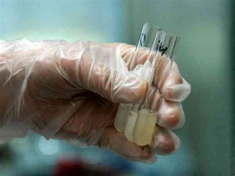 正常男性精子颜色标准图是怎样的？精子数量多少正常？ 名医在线