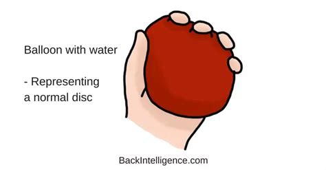 Bulging Disc Exercises In Lower Back Do These At Home Bulging Disc