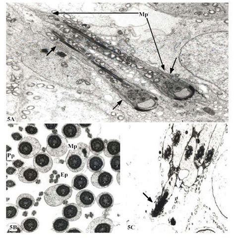 Electron Micrographs Of Testis Sections From A Control Rats Showing Download Scientific